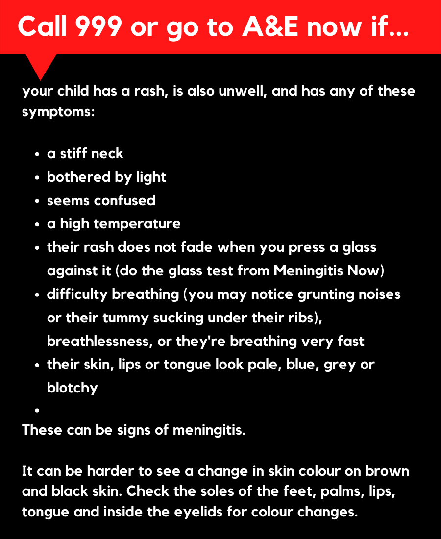What Are Baby Milk Spots Baby Bump Baby And You Pregnancy